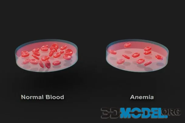 3D Model – Normal Blood Cells Vs Anemia (PBR)