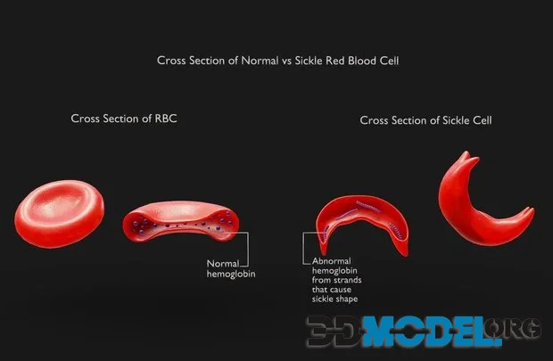 3D Model – Normal Vs Sickle Red Blood Cell Cross Section (PBR)